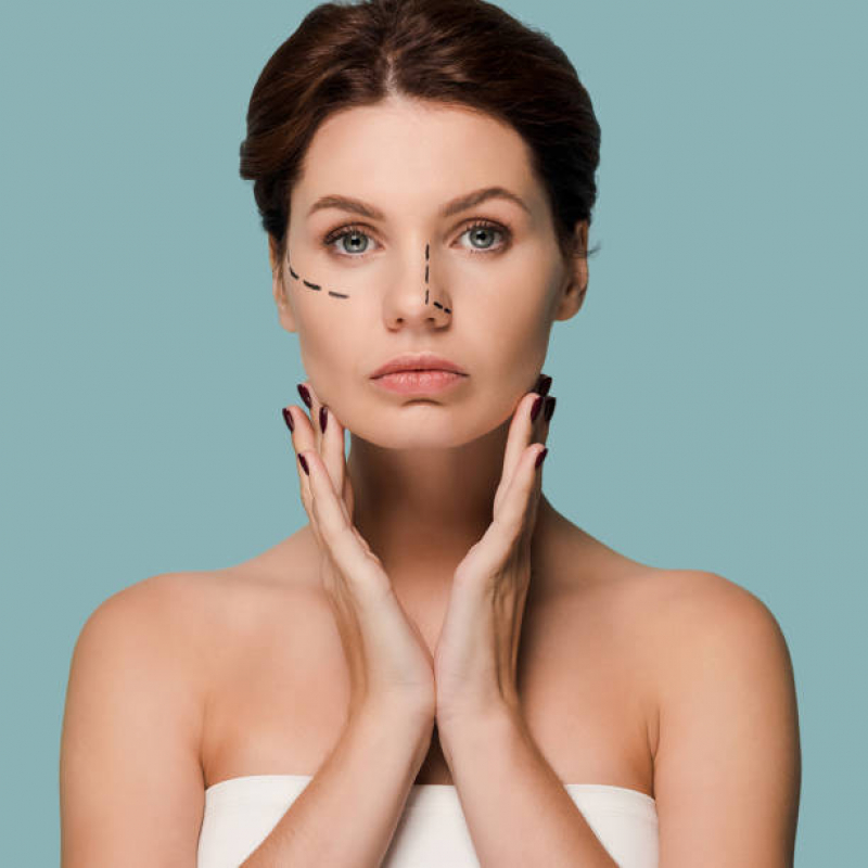 Procedimento de Fios Lisos de Pdo - Clínica Holosi